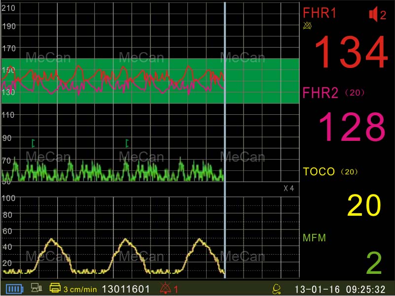 Fetal Maternal Monitoring Solution | China Supplier