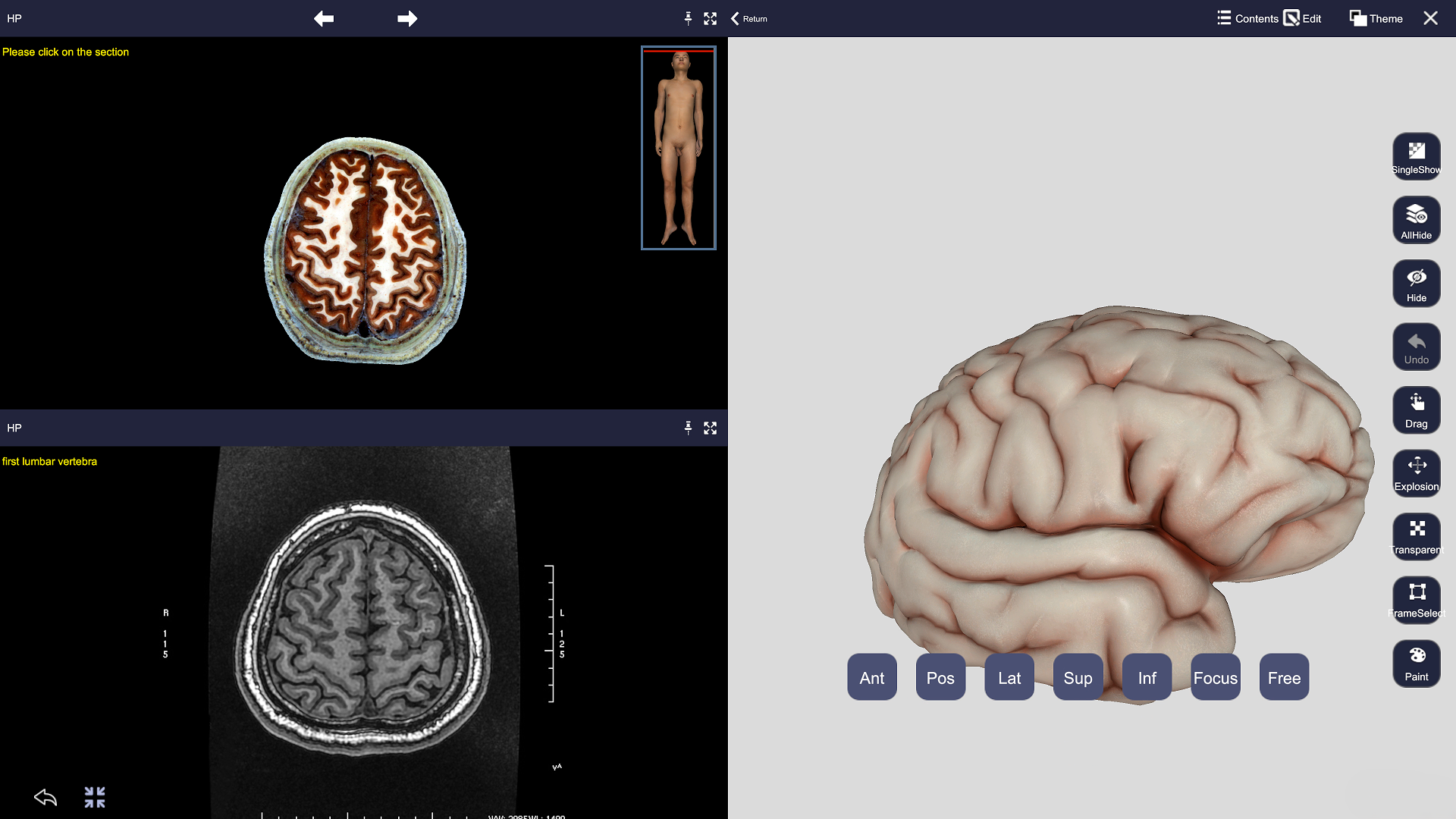 Unleashing the Power of 3D Table in Anatomy Education