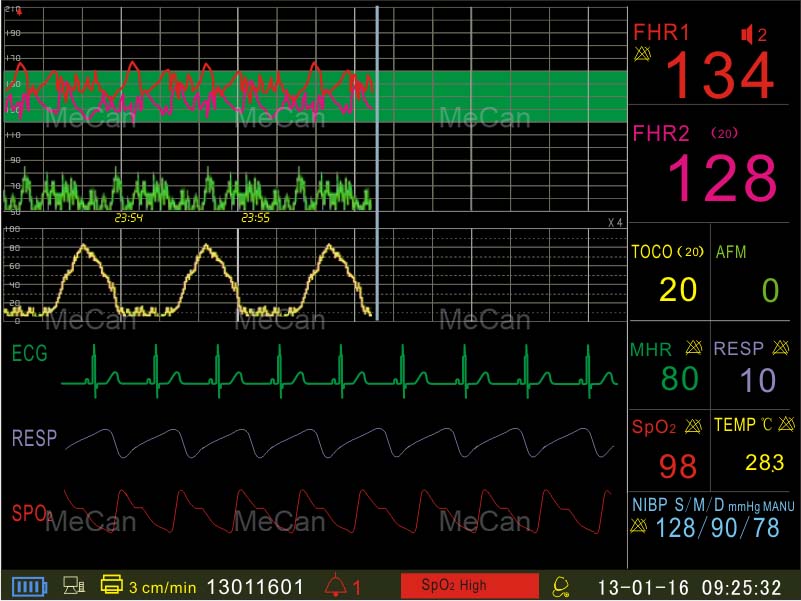 Fetal Maternal Monitoring Solution | China Supplier