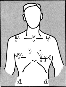 Your Essential 2024 ECG Guidelines
