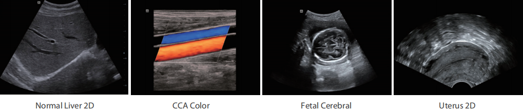 Mindray DC-26 Ultrasound Diagnostic Machine