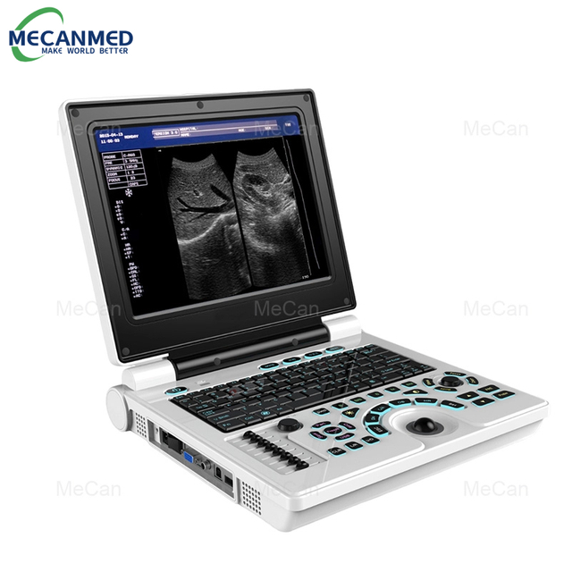Ultrasound Machine Supplier - MeCan Medical