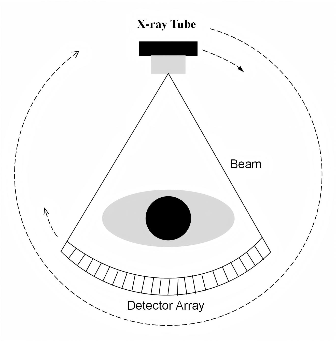 CT-scan versus MRI-machines: belangrijkste verschillen in medische beeldvorming