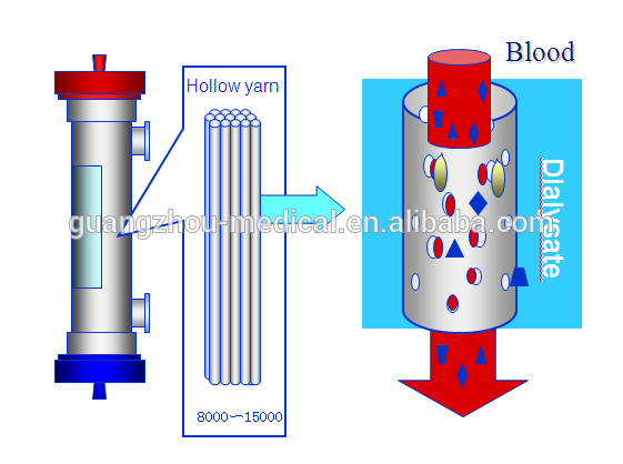 China Disposable Medical Hollow Fiber Dialyzer Blood Dialysis ...