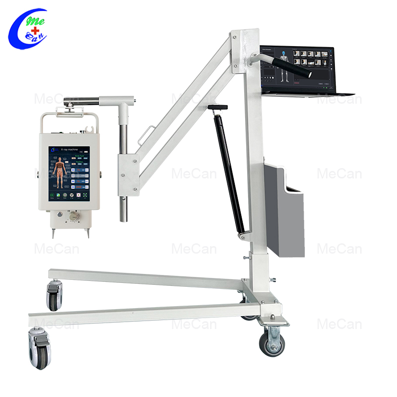 Advanced Portable DR System with 5.6kW Power and Touch Screen Control