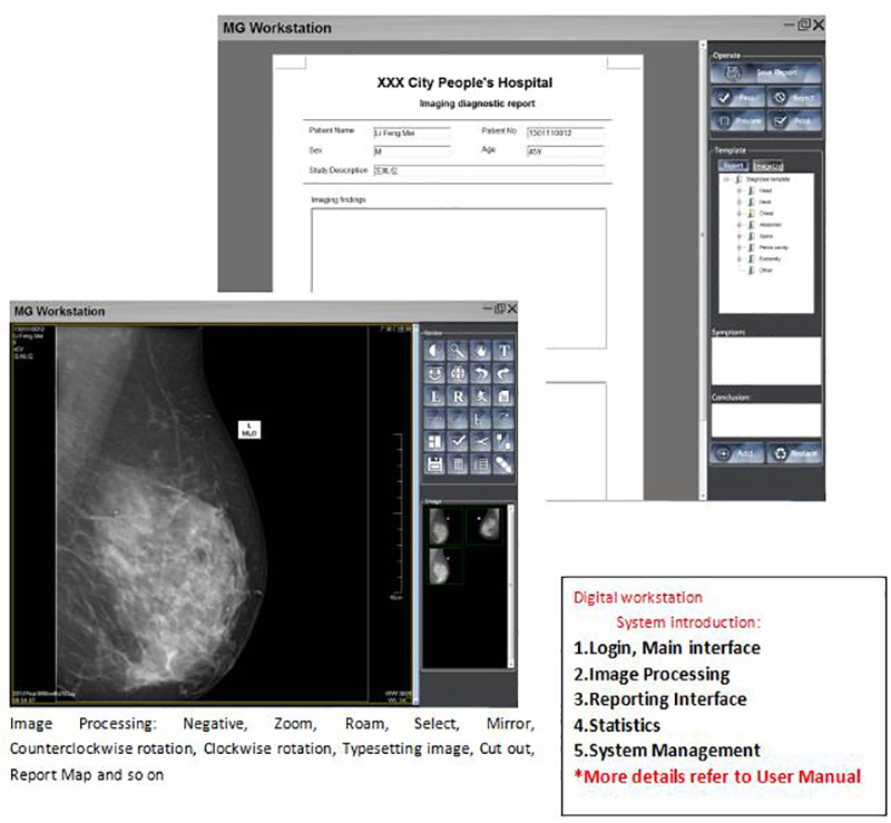 High Quality Digital Mammography System Mammography Machine ...