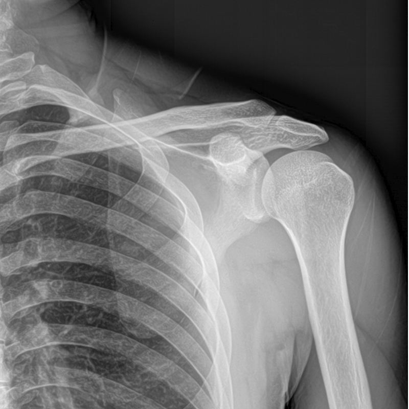 High Quality Wireless X Ray Digital FPD Flat Panel Detector from China ...