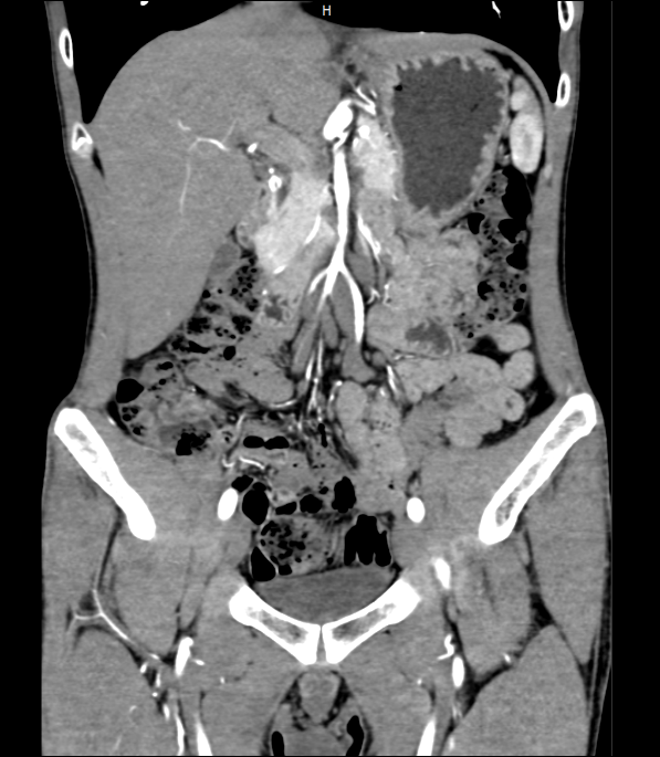 Pentru ce este folosit un aparat de scanare CT? | Un ghid cuprinzător ...