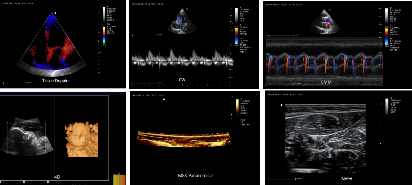 Trolley Colour Doppler Ultrasound Machine