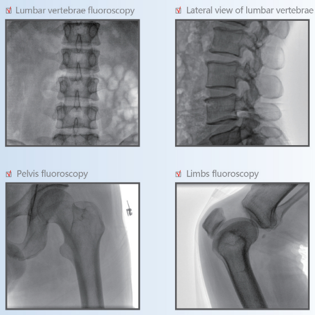 Digital FPD C-arm X-ray System