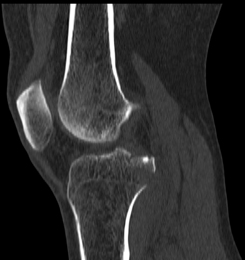 Għal xiex Użat Magni CT Scan? | Gwida Komprensiva - MeCanMedical