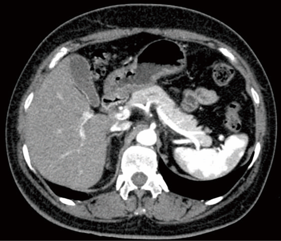 New vs Refurbished CT Scan Machines: Which One Is Better for Your Facility?