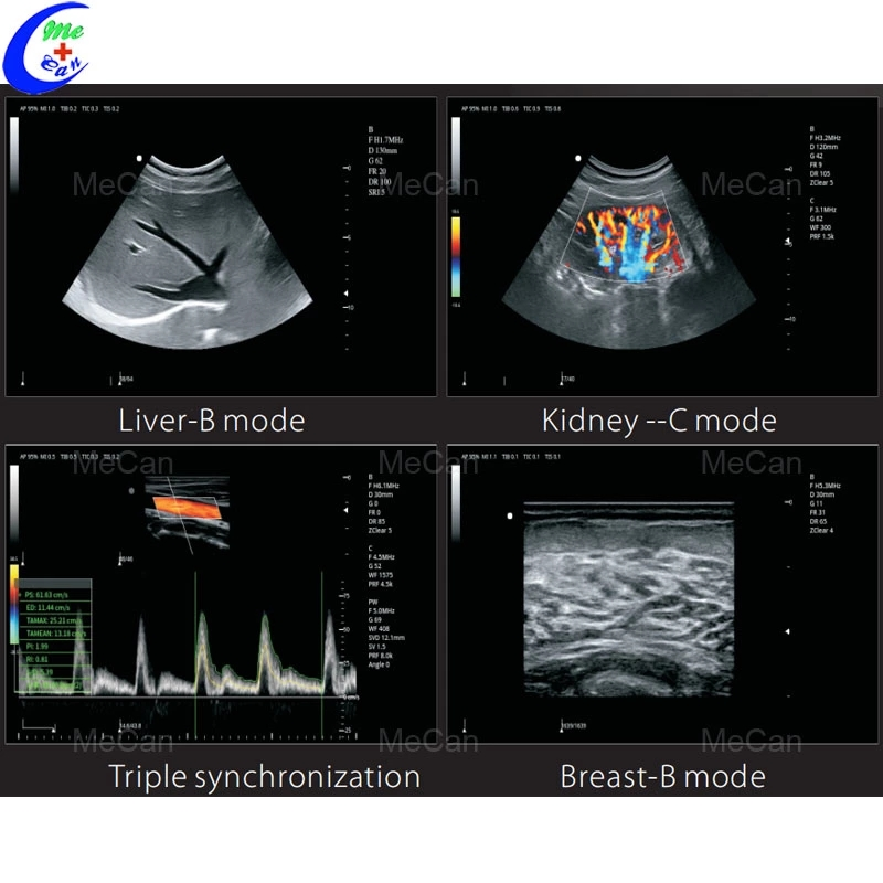 3D 4D Color Doppler Ultrasound Machine MeCan Medical from China ...