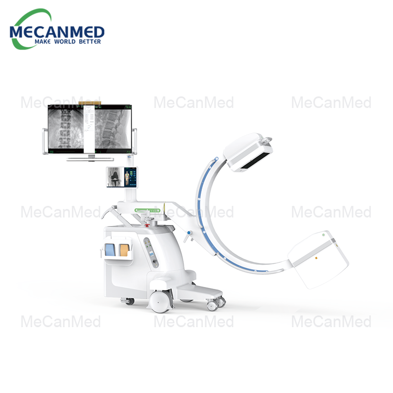 Mobile Dynamic Flat-Panel C-arm စနစ်