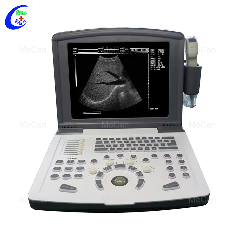 Quality B/W Ultrasound Machine, Full Digital Ultrasound Scanner ...